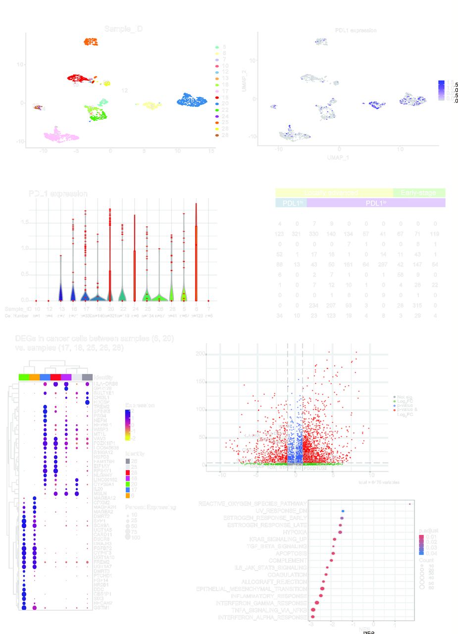 Cancer cell-specific PD-L1 expression is a predictor of poor outcome in ...