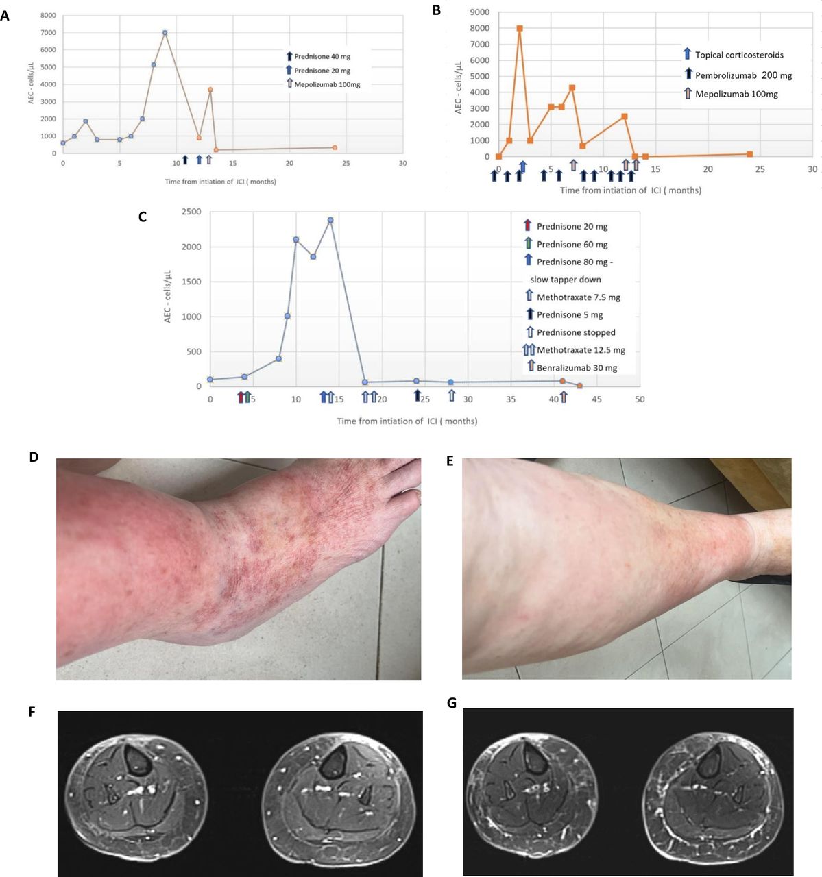 Targeted inhibition of the IL5 axis for immune checkpoint inhibitors ...