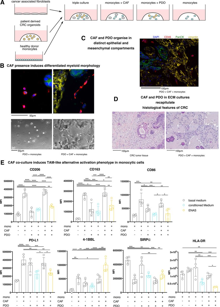 Cancer-associated fibroblasts shape early myeloid cell response to ...