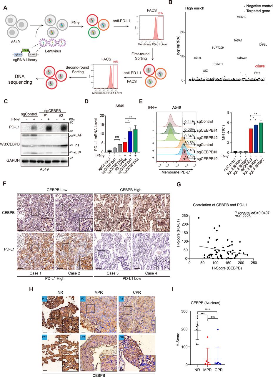N-terminal acetylation of transcription factor LIP induces immune ...