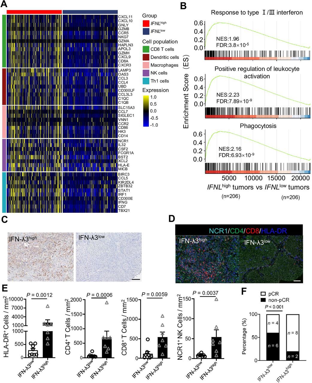 Type III interferon inhibits bladder cancer progression by ...