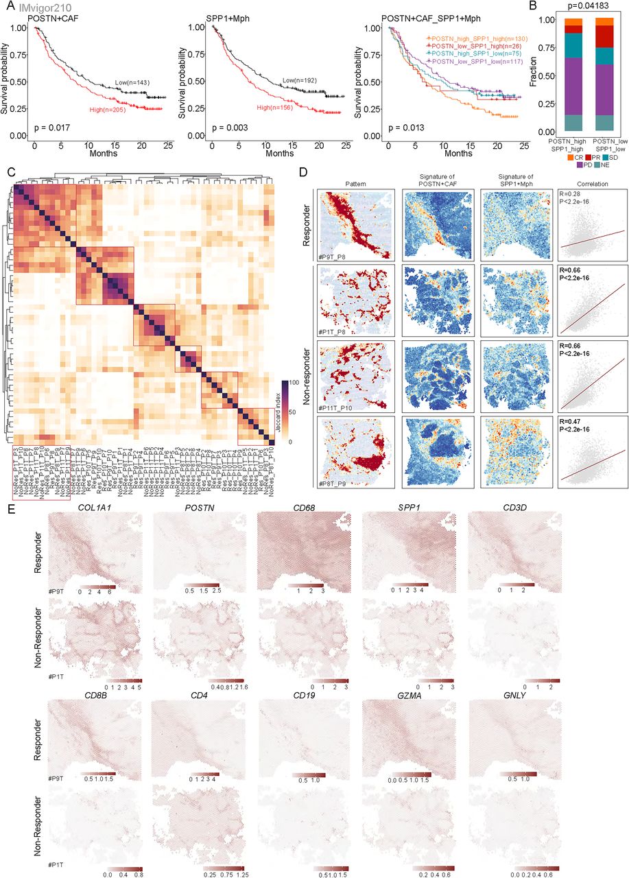 POSTN+ cancer-associated fibroblasts determine the efficacy of ...