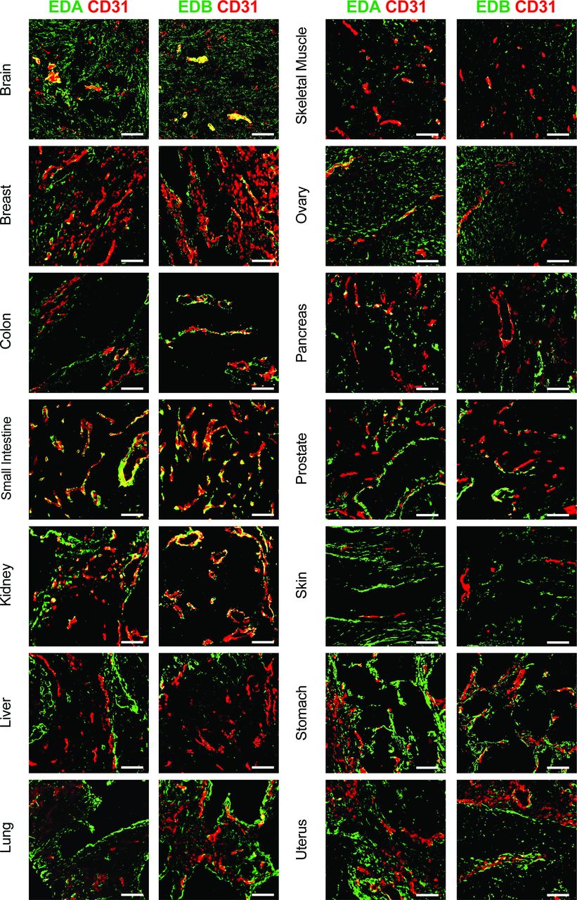 An IL-7 fusion protein targeting EDA fibronectin upregulates TCF1 on ...