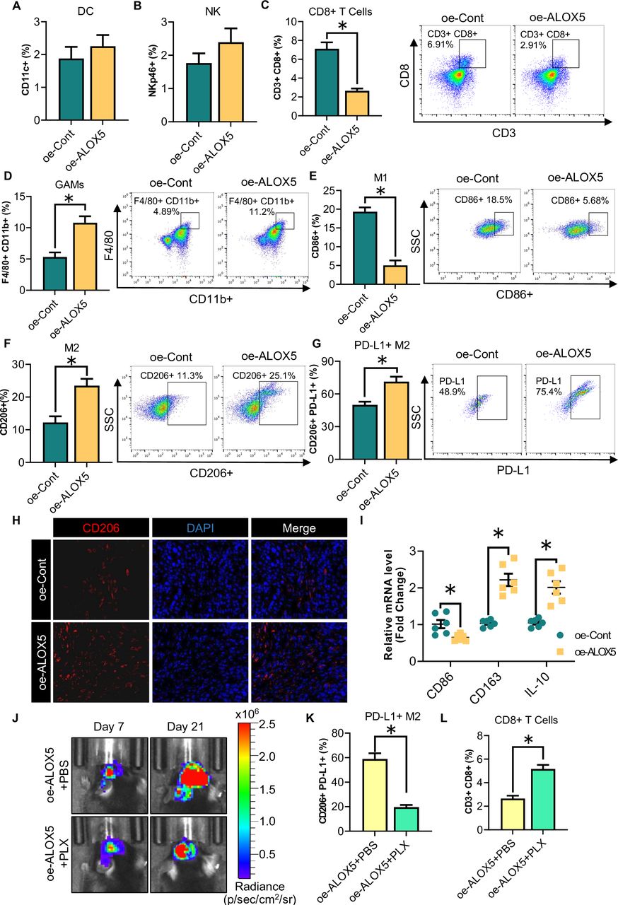 ALOX5 contributes to glioma progression by promoting 5-HETE-mediated ...