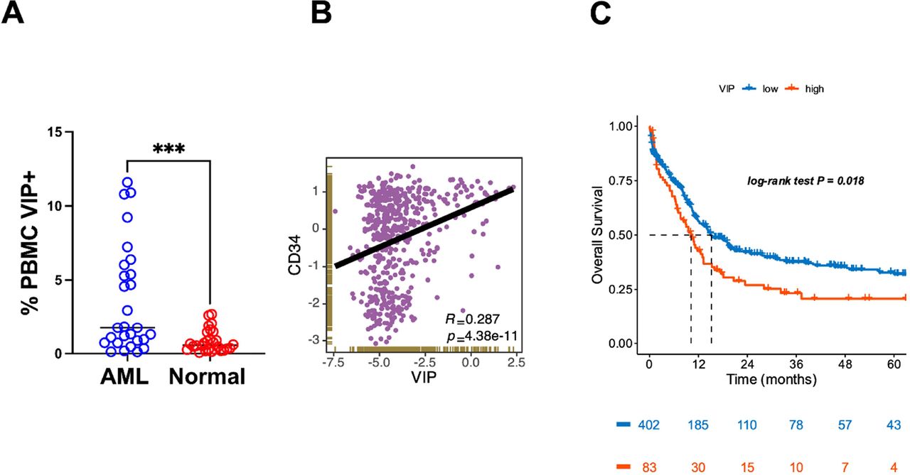 1347 VIP Biology drive prognosis in AML patients | Journal for ...