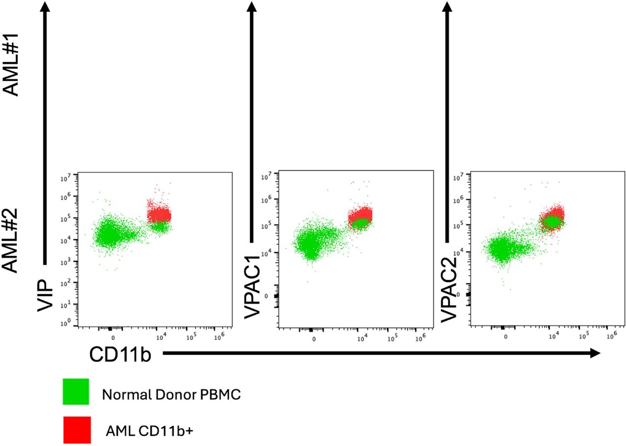 1347 VIP Biology drive prognosis in AML patients | Journal for ...