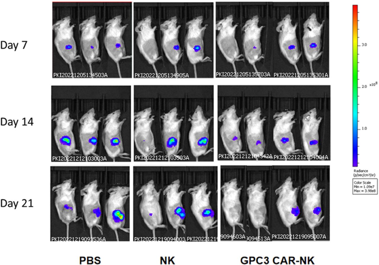 304 Antitumor activity of GPC3 chimeric antigen receptor modified NKT ...