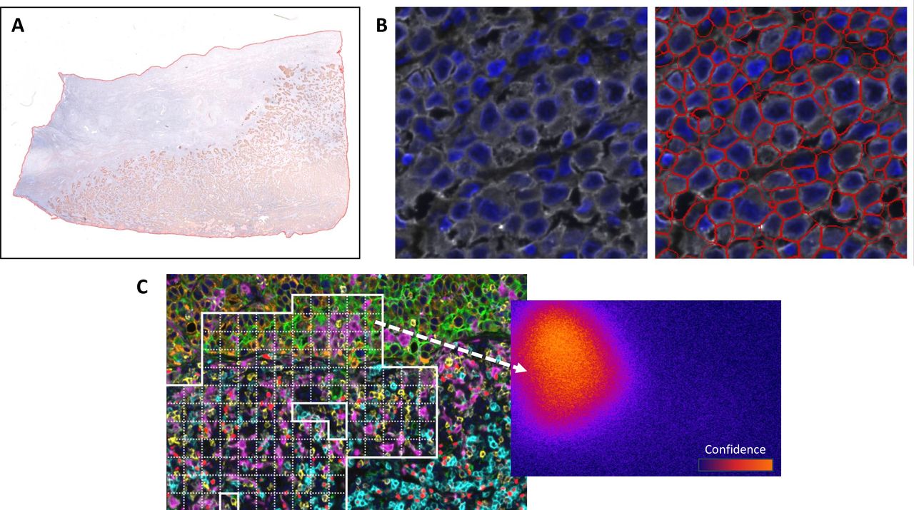 Society for Immunotherapy of Cancer: updates and best practices for ...