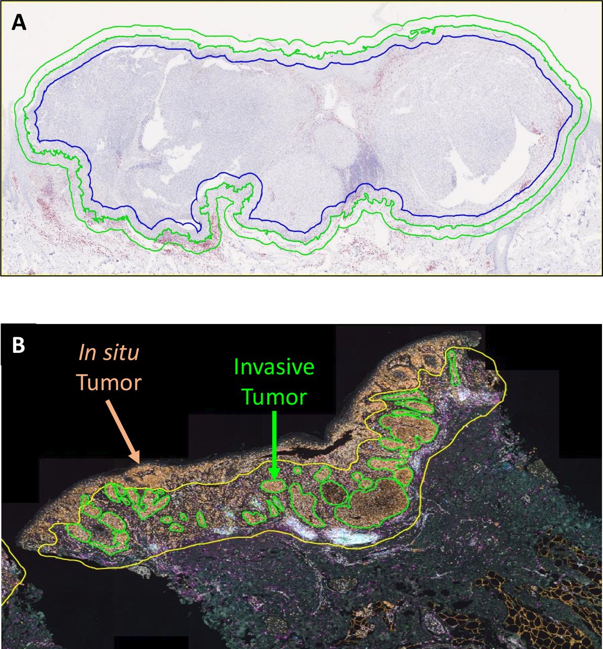 Society for Immunotherapy of Cancer: updates and best practices for ...