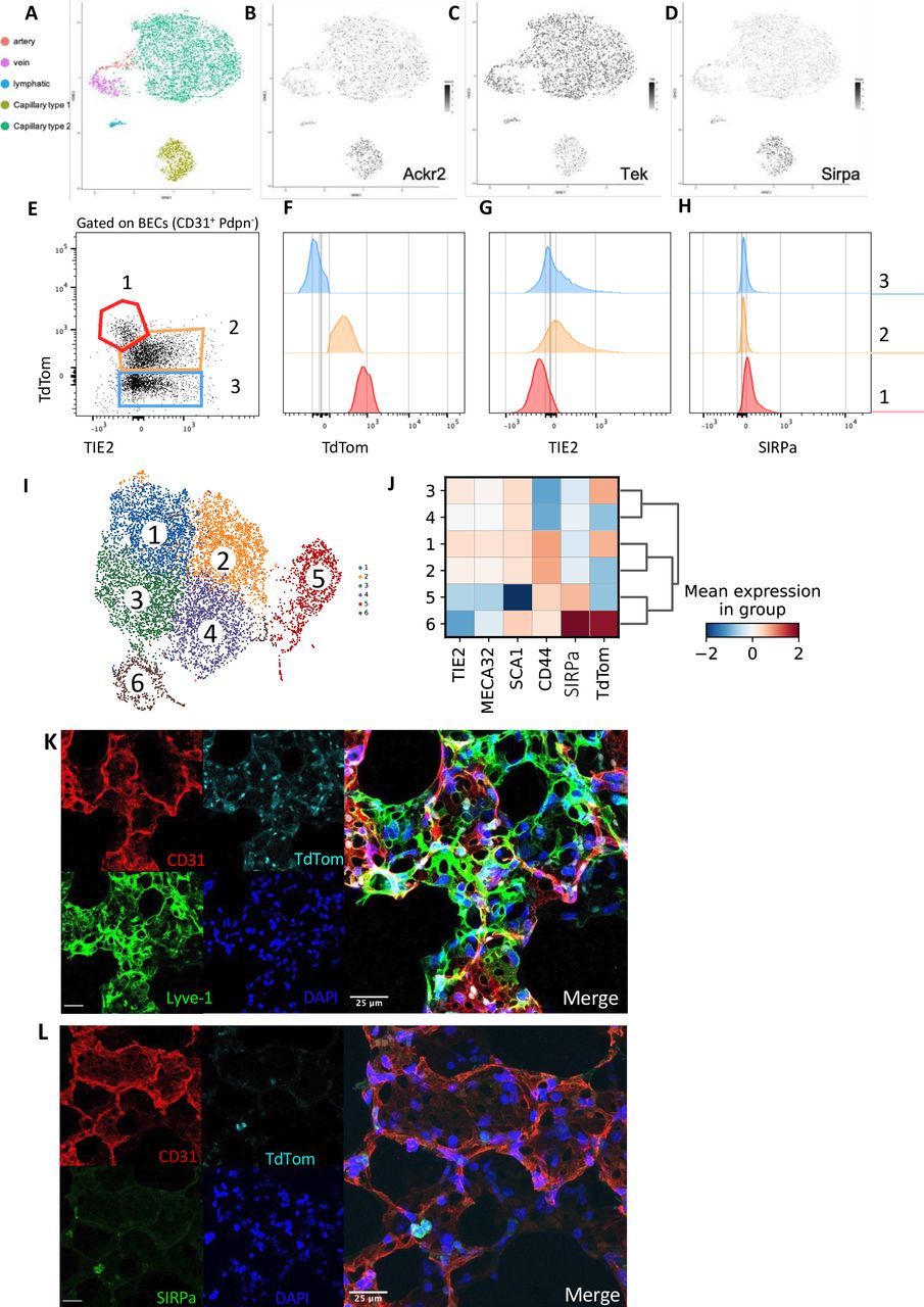 Selective expression and significance of ACKR2 in lung aerocytes ...