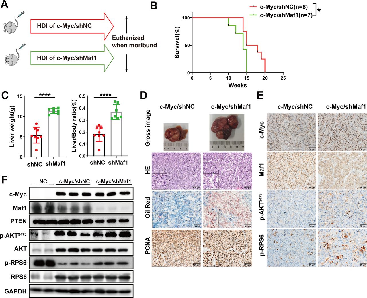 MAF1 inhibits hepatocarcinogenesis by fostering an immunostimulatory ...
