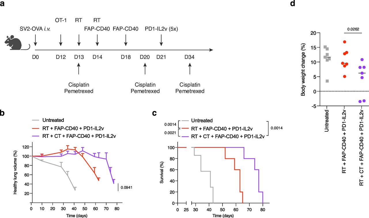 PD-1 cis-targeted IL-2v in combination with radiotherapy inhibits lung ...