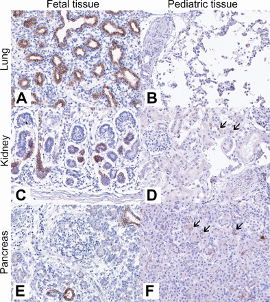 Claudin 6 is a suitable target for CAR T-cell therapy in atypical ...