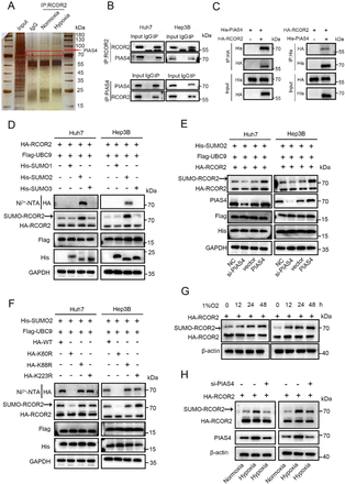 Hypoxia-induced RCOR2 promotes macrophage M2 polarization and CD8+ T ...