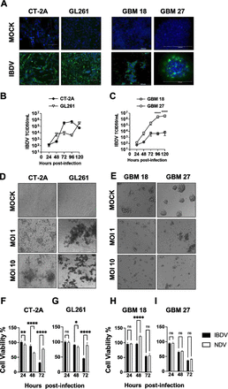 Infectious bursal disease virus (IBDV) as a novel oncolytic virotherapy ...