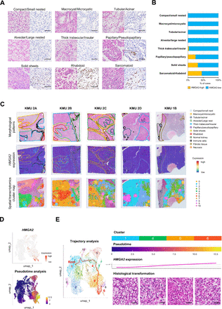 HMGA2 links morphological evolution and microenvironment dynamics to ...