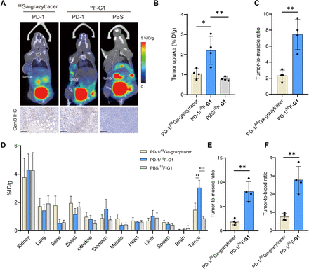 Development of a novel 18F-labeled radiotracer targeting granzyme B for ...