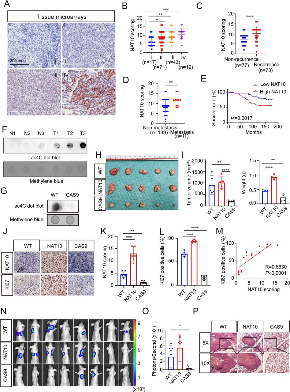 Acetyltransferase NAT10 inhibits T-cell immunity and promotes ...