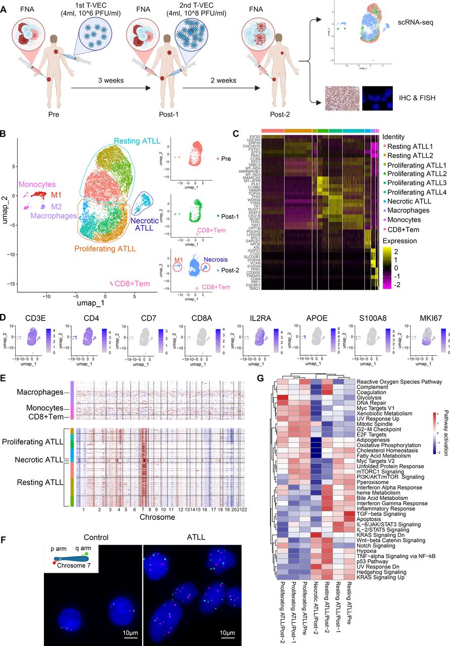 Single-cell analysis of oncolytic virotherapy in adult T-cell leukemia ...
