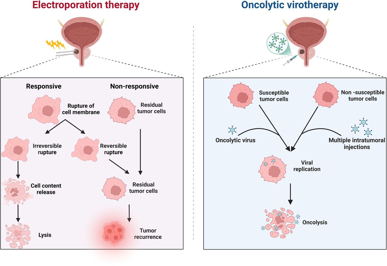 Irreversible electroporation synergizes with oncolytic virus enhances ...