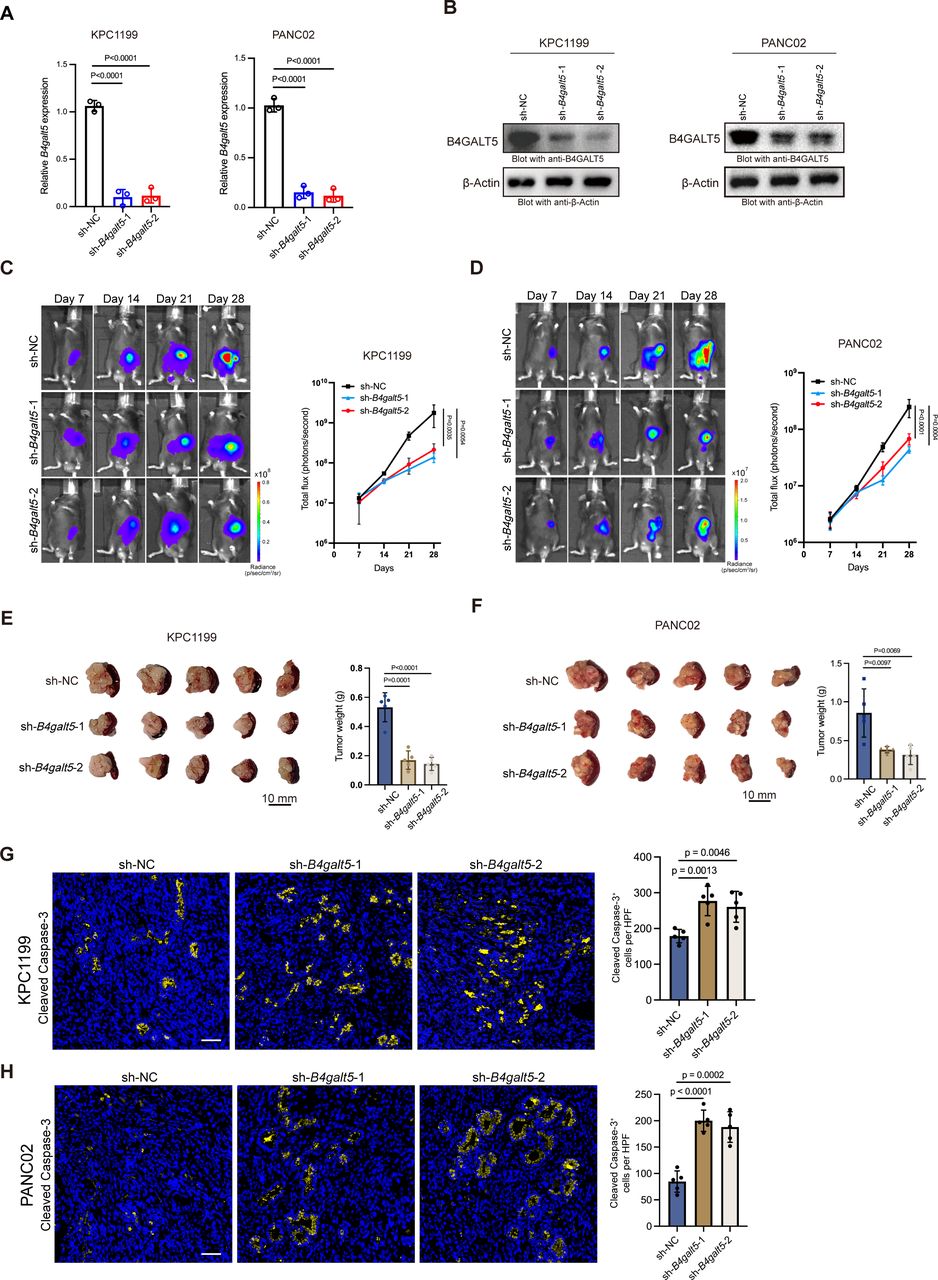 B4GALT5 inhibits CD8+ T-cell response by downregulating MHC-I level ...