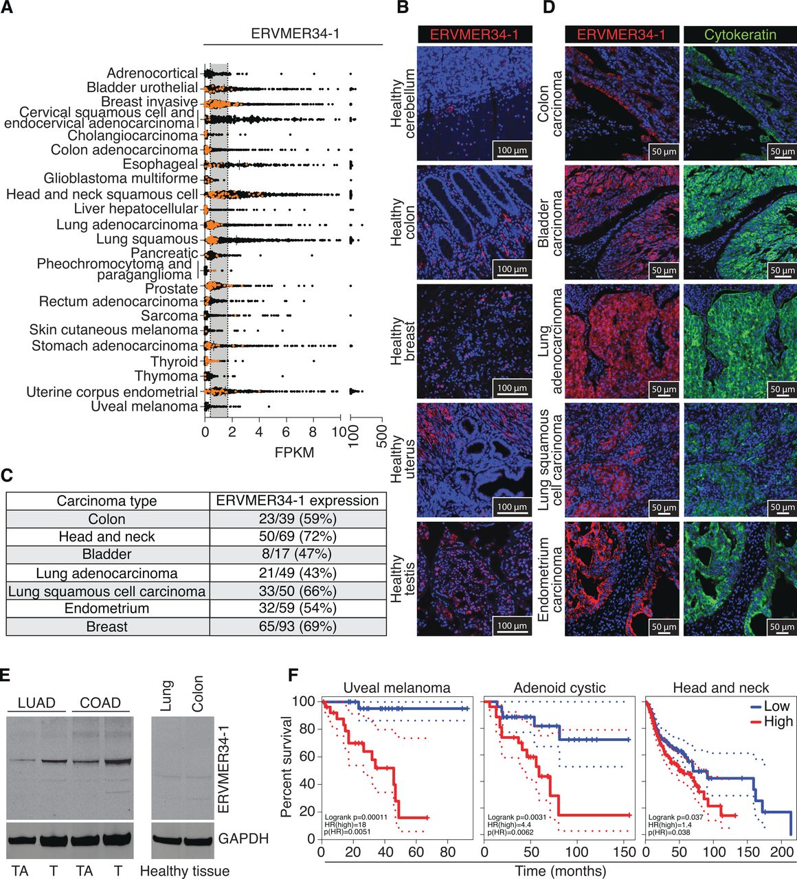 Combination of a therapeutic cancer vaccine targeting the endogenous ...