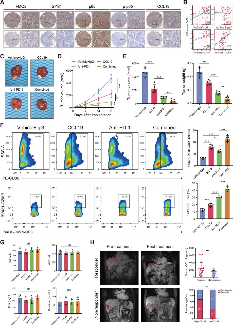 FMO2+ cancer-associated fibroblasts sensitize anti-PD-1 therapy in ...