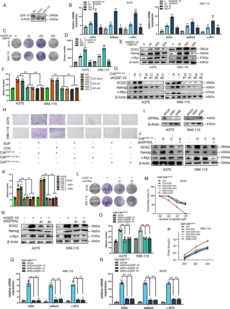 Ectopic expression of GDF15 in cancer-associated fibroblasts enhances ...