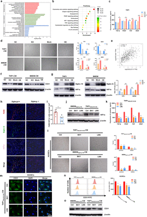 IL-4-STAT6-induced high Siglec-G/10 expression aggravates the severe ...