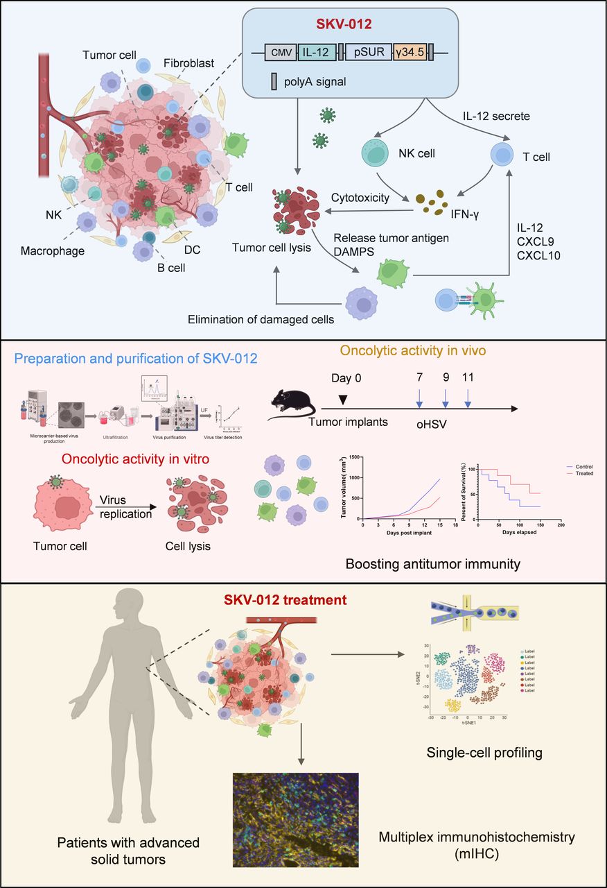 Preclinical and clinical evaluation of intratumoral injection of an IL ...