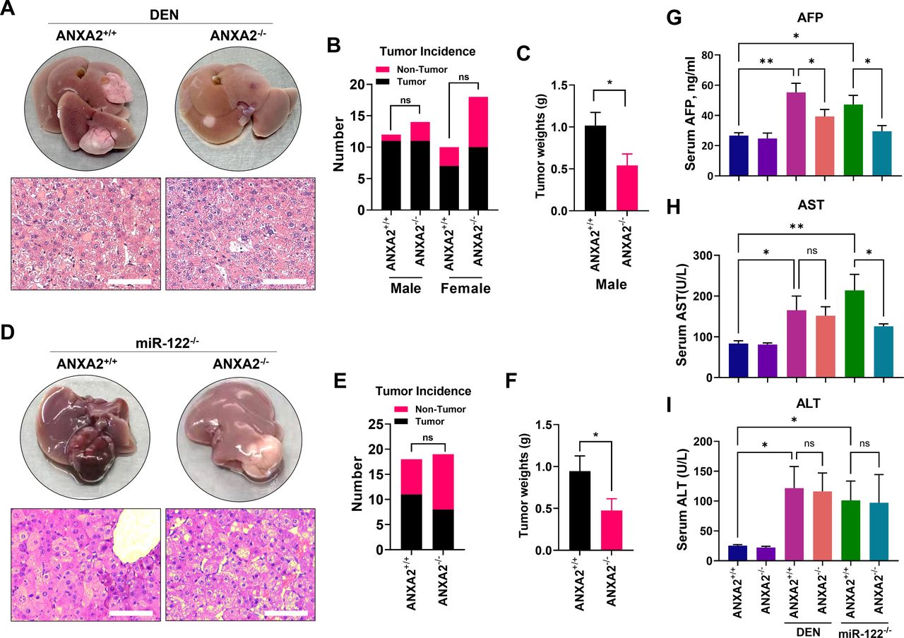 Targeting Annexin A2 to reactivate tumor-associated antigens ...