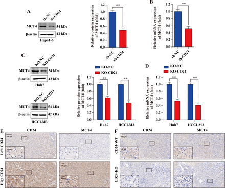 CD24 recruits tumor-associated neutrophils to promote the progression ...