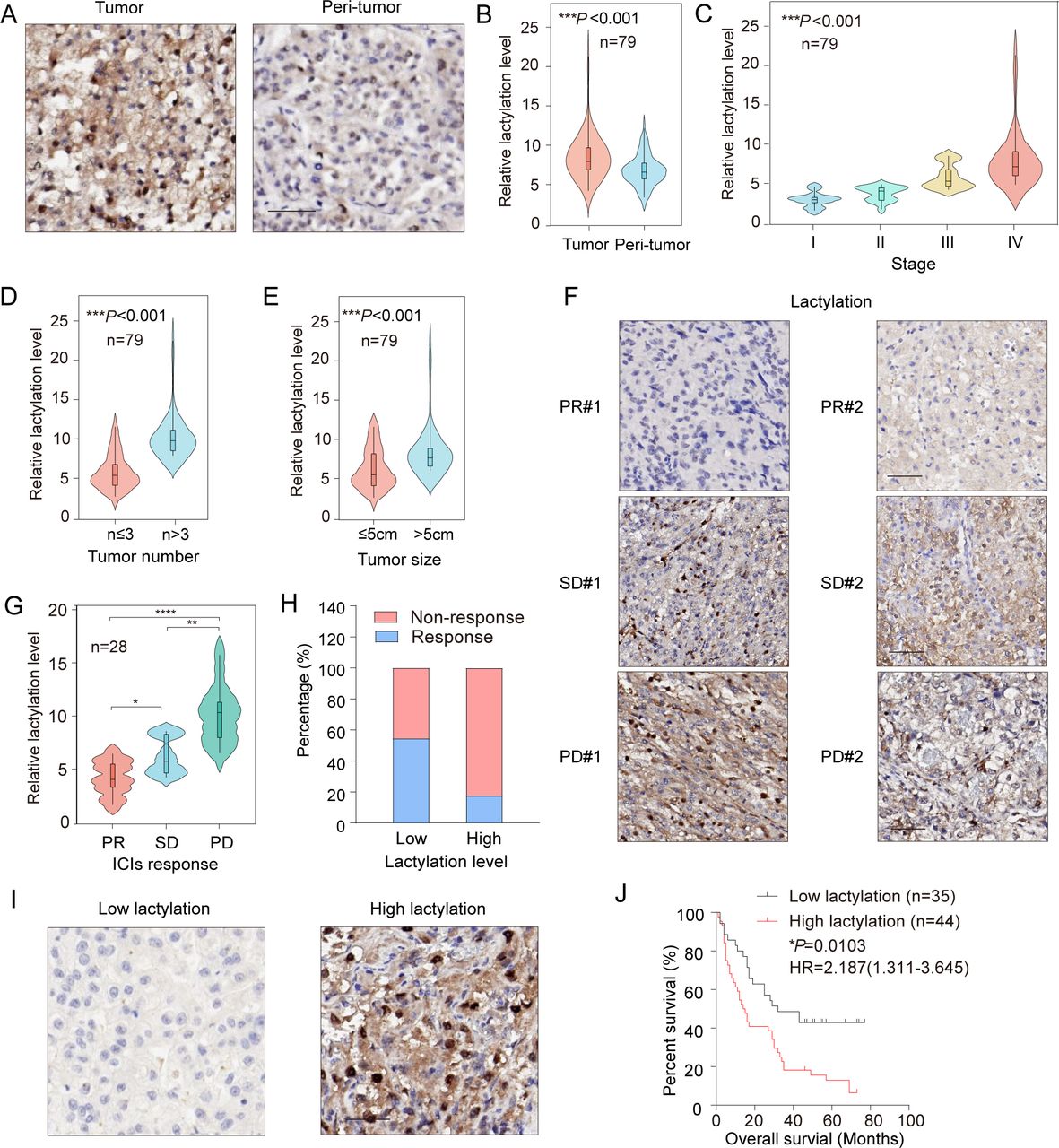 Lactylation-driven MVP upregulation boosts immunotherapy resistance by ...