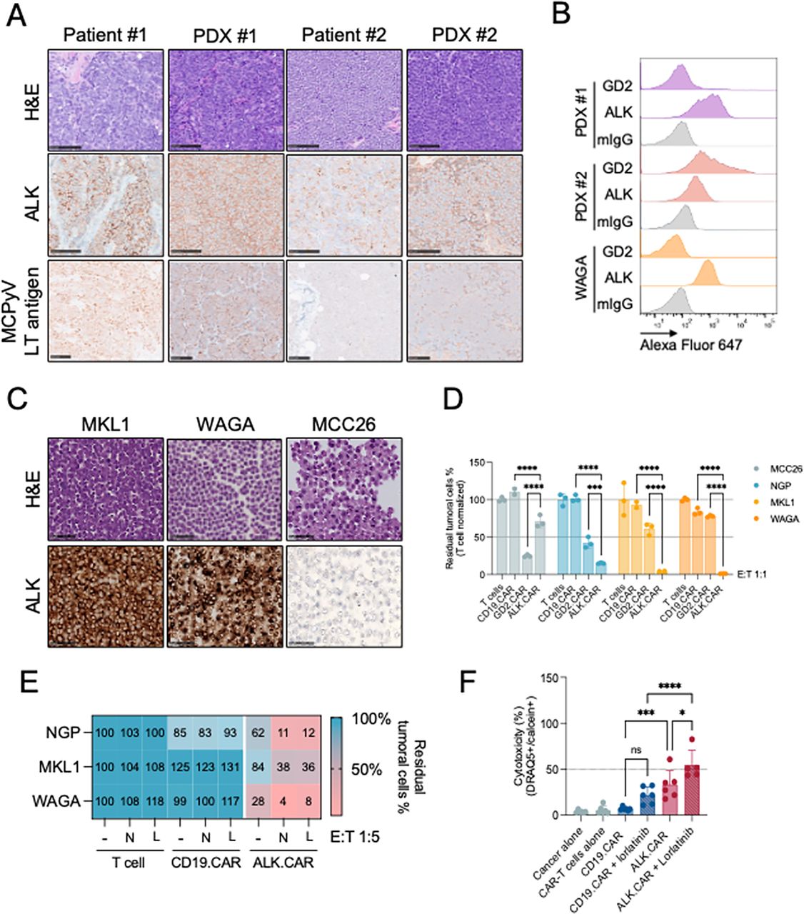 225 ALK.CAR-T cells as a new potential treatment for ALK+merkel cell ...