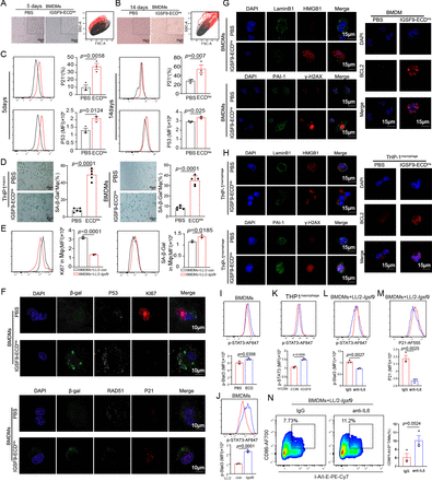 Tumor-associated macrophages educated by IGSF9 exhibit a senescence ...