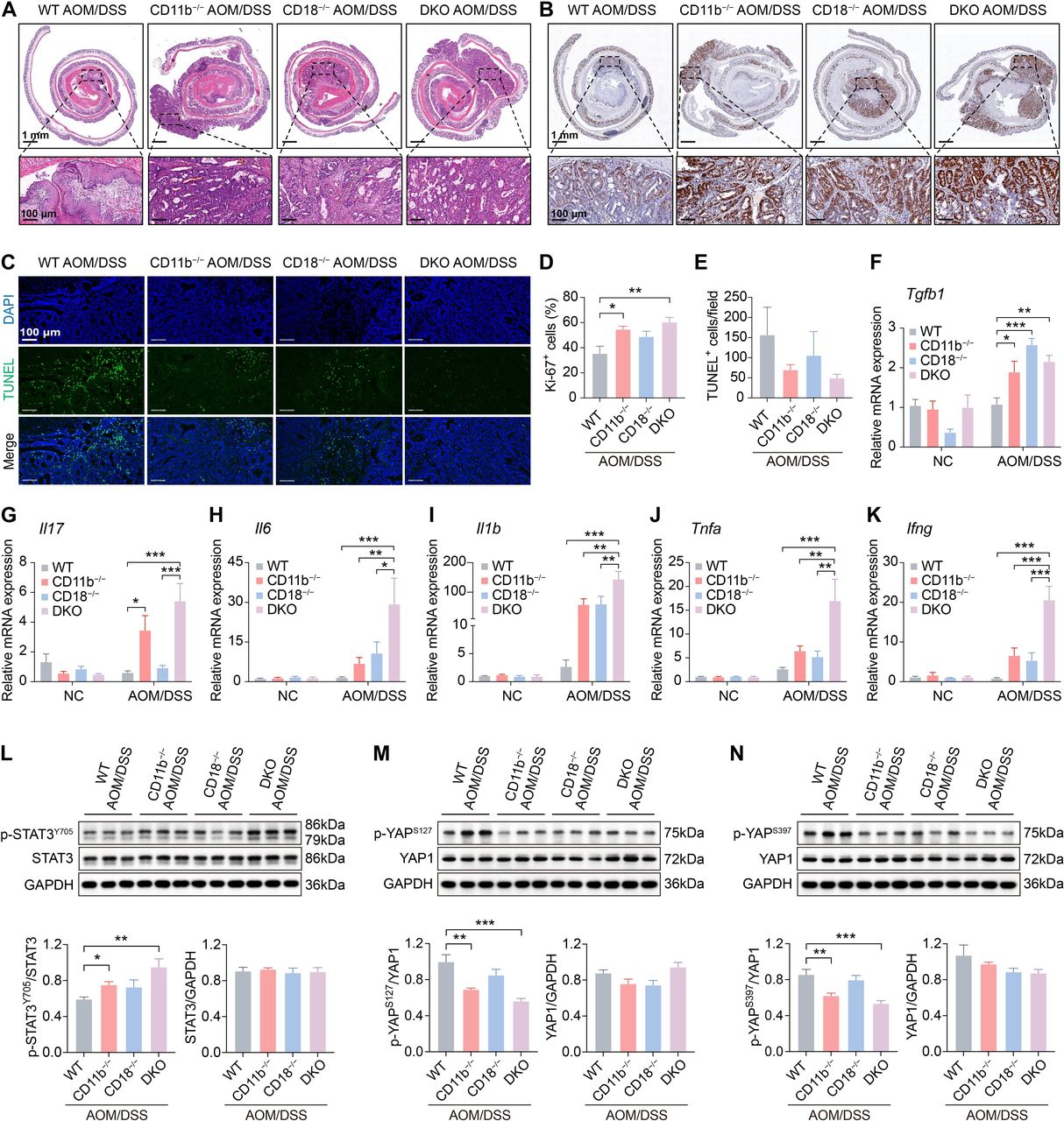 Integrin CD11b/CD18 reprograms macrophage polarization by suppressing ...