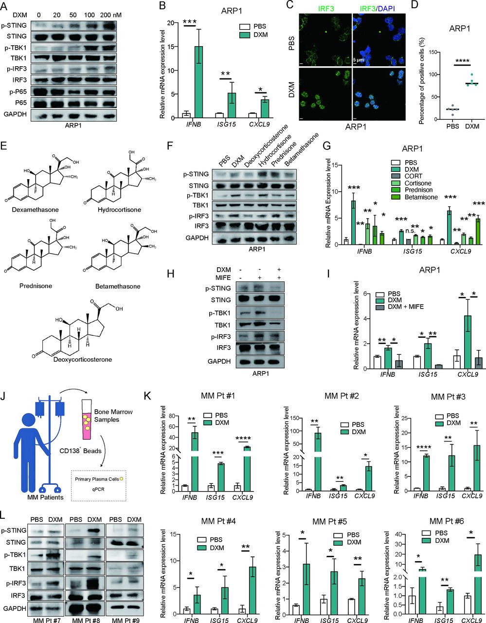 Dexamethasone activates anti-tumor immunity in multiple myeloma by ...
