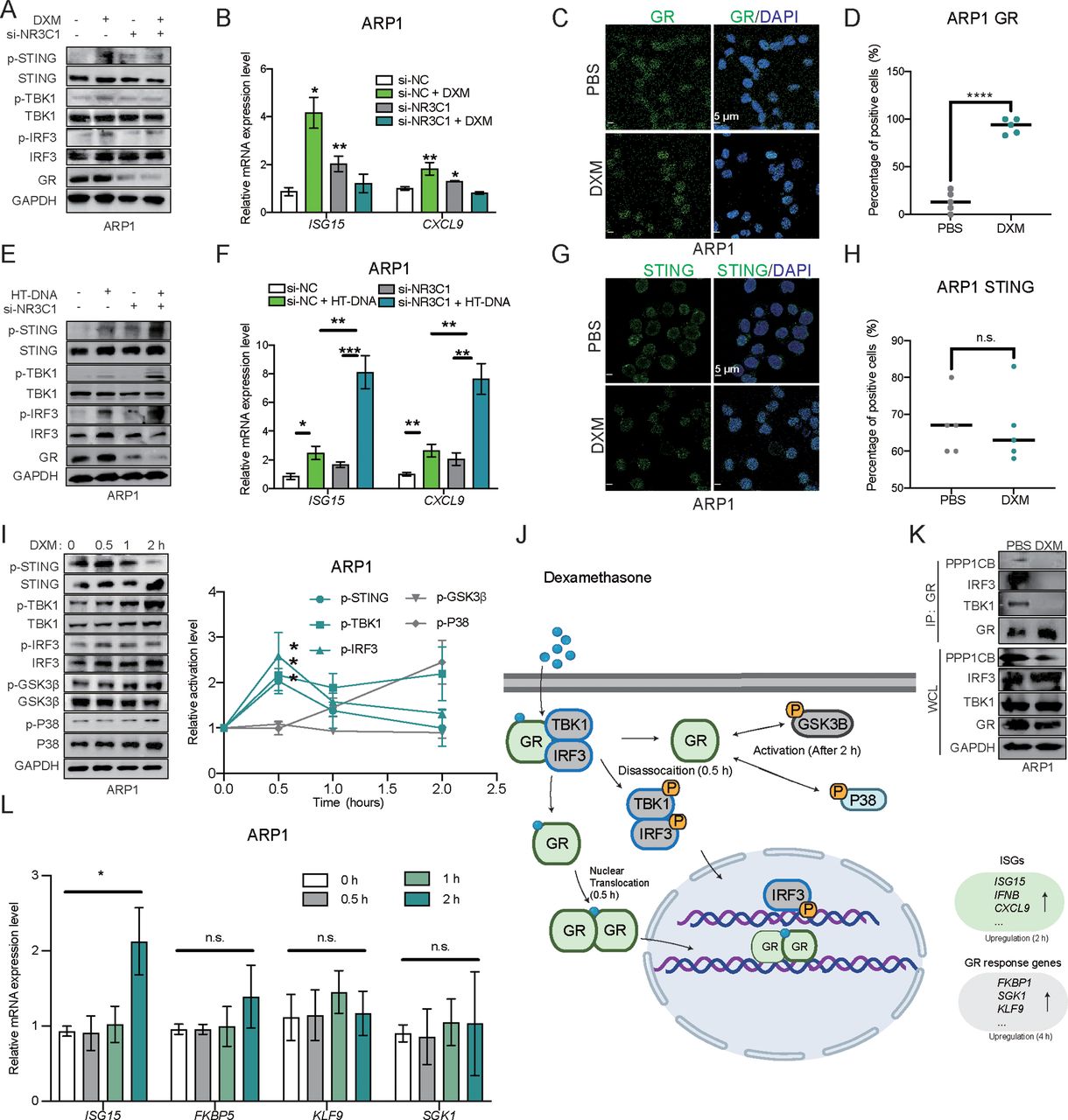 Dexamethasone activates anti-tumor immunity in multiple myeloma by ...